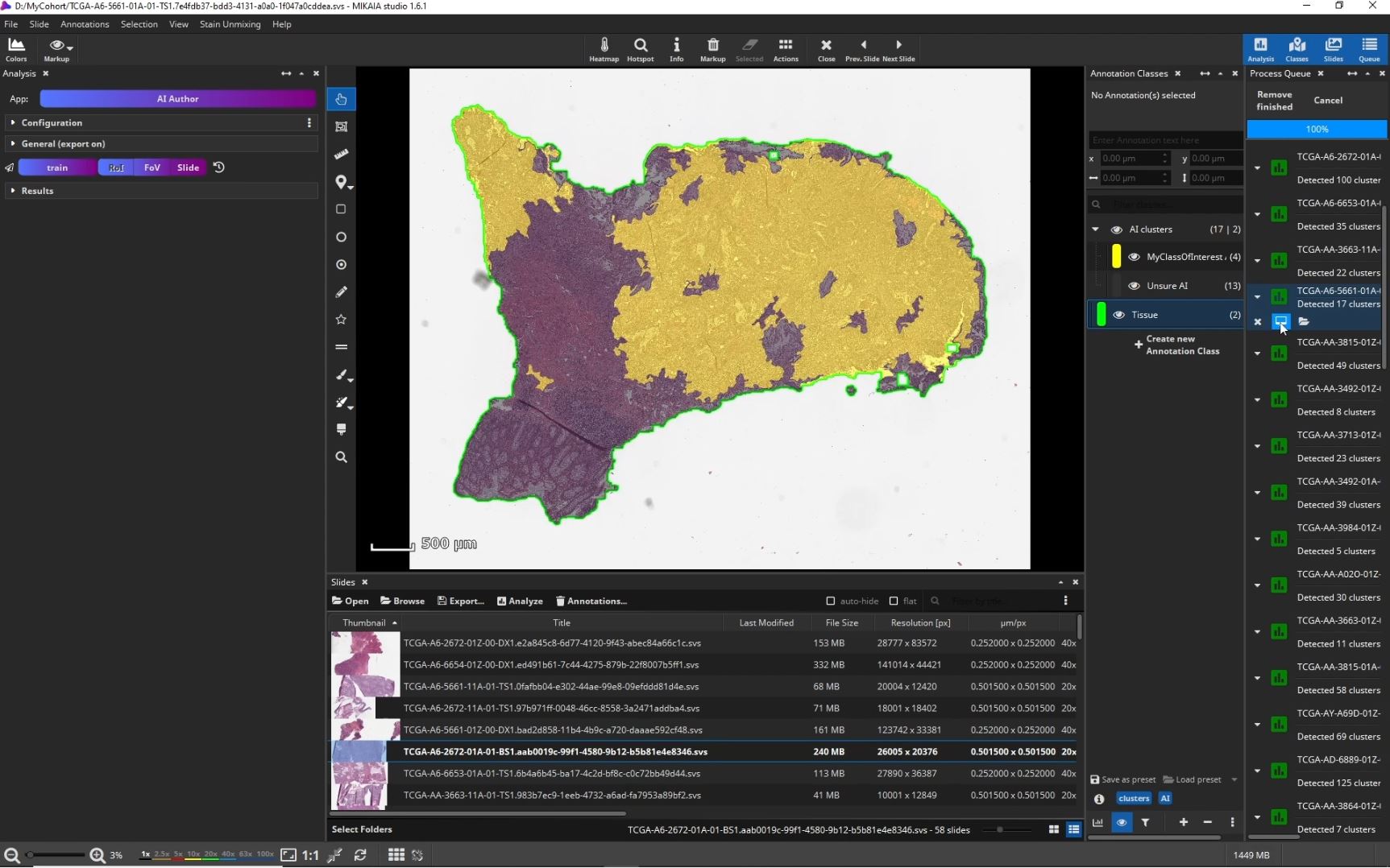 Digital Pathology batch analysis with MIKAIA® AI Author